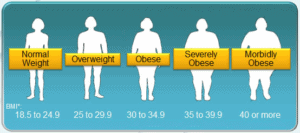 Is Obesity Genetic? | Decode your DNA and learn about your risks!