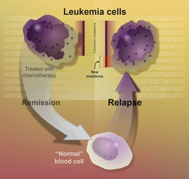 Is Leukemia Genetic? | Decode your DNA and learn about your risks!
