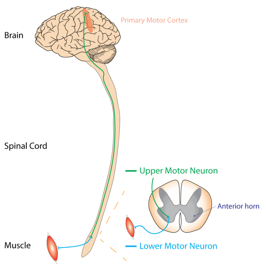 Is ALS Genetic? | Decode your DNA and learn about your risks!