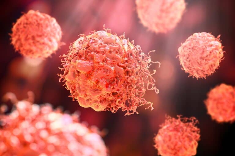 A Genetic Map Uncovering the Heritability of Sarcoma